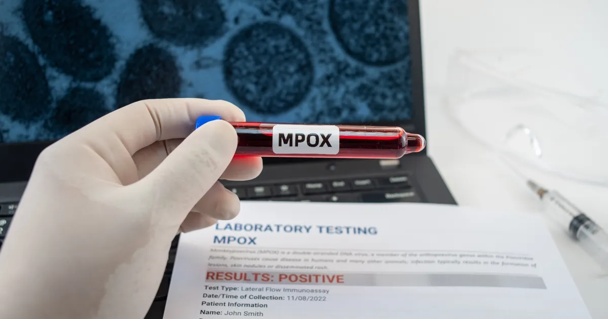 Emergencia por Mpox: Todo lo que Debes Saber sobre el Brote y su Manejo - Medical Impact